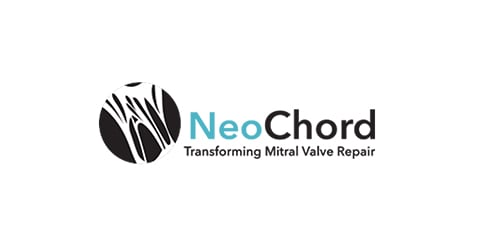 Baird Capital Portfolio Company NeoChord Announces Successful In-Human ...